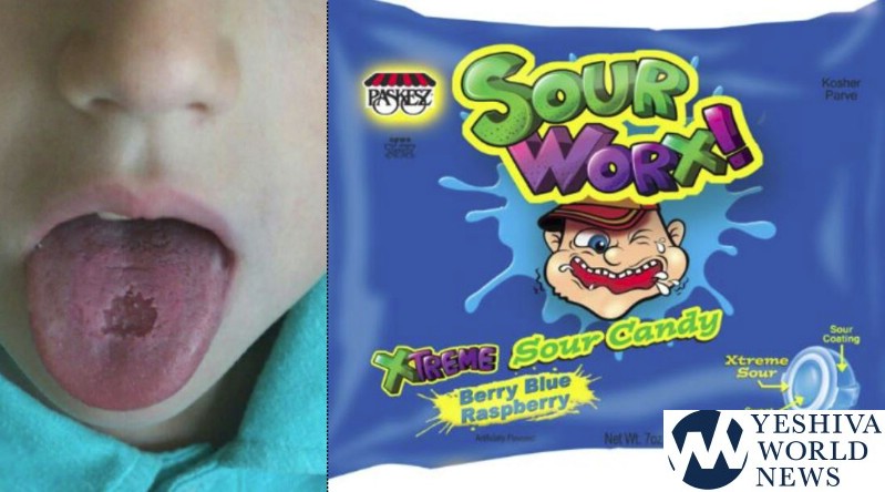 UPDATE: Paskesz Suspends Production of ‘Sour Worx’ Candy After Child ...